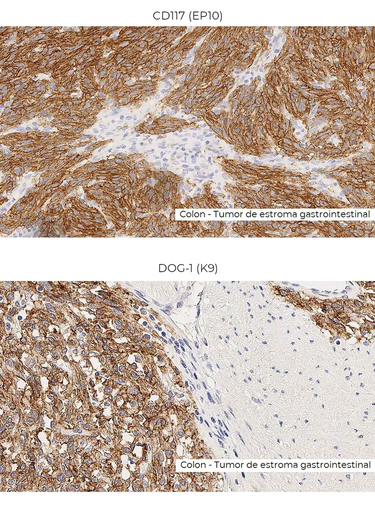Patología Gastrointestinal | BIO-OPTIC S.R.L.