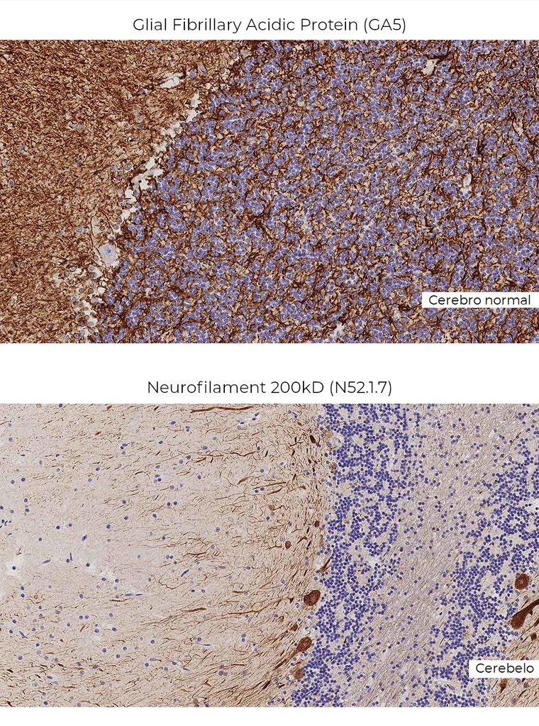 Neuropatología | BIO-OPTIC S.R.L.