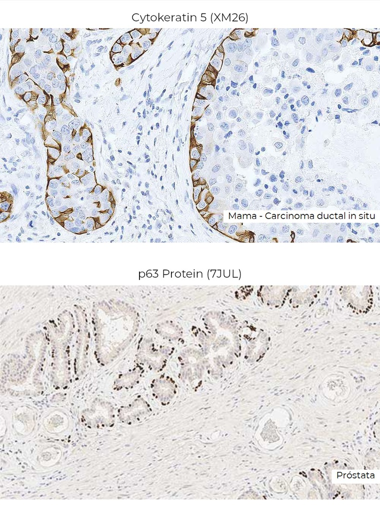 Patología Urológica | BIO-OPTIC S.R.L.